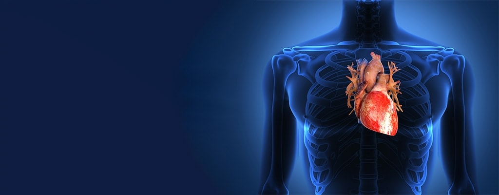 Structural Heart Intervention | TE Connectivity