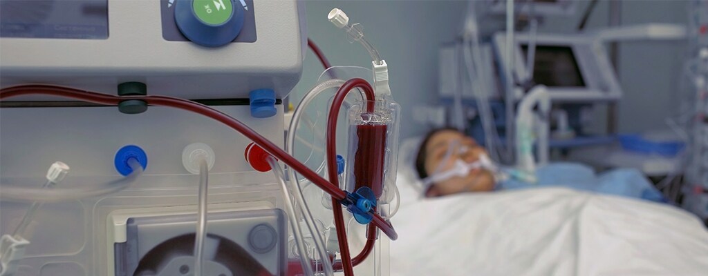 Sensors for Dialysis Machines | TE Connectivity